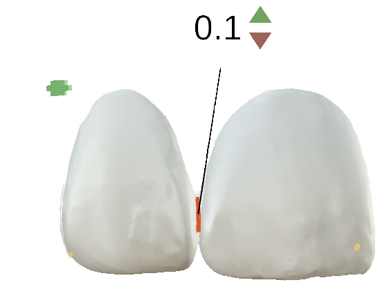 ArchForm - Simple, powerful 3D software to setup aligner cases
